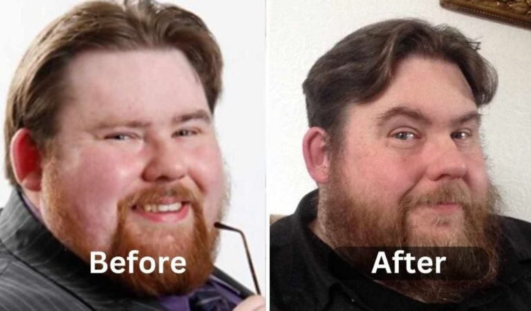 Michael Baggott Weight Loss Linked To Illness - Is He Sick?